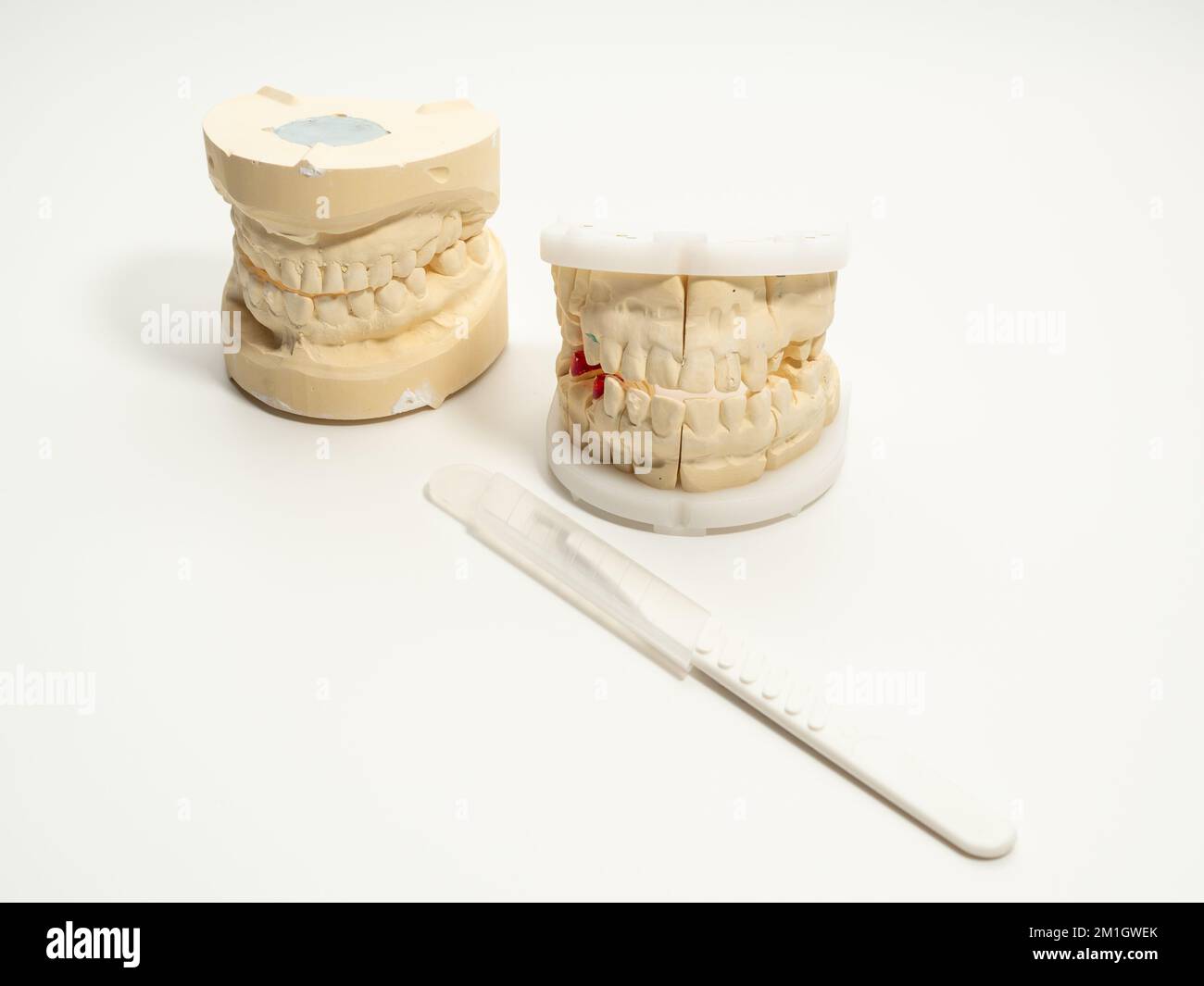 Dental casts on a white background. Plaster model of teeth. Close-up ...