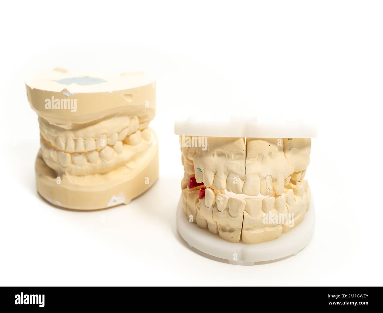 Dental casts on a white background. Plaster model of teeth. Close-up ...