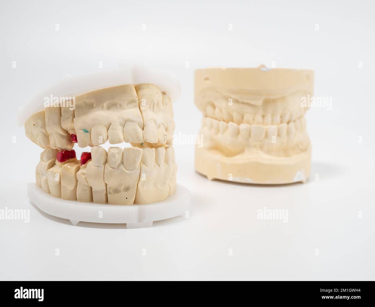 Dental casts on a white background. Plaster model of teeth. Close-up ...