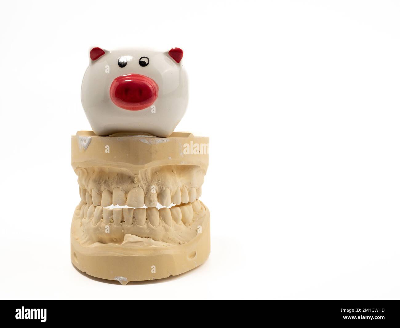 Dental casts and a piggy bank on a white background. Plaster model of ...