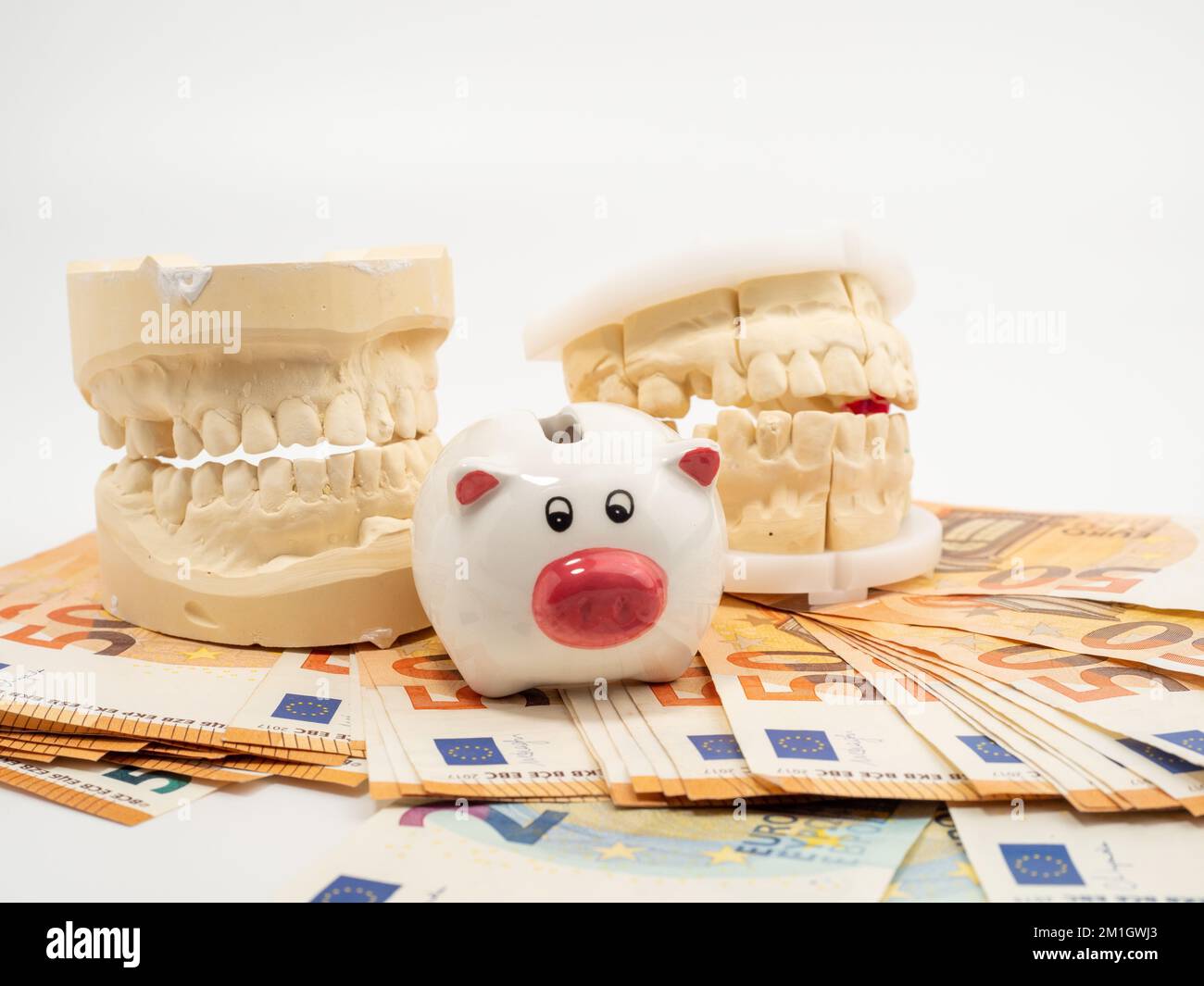 Dental casts, piggy bank and banknotes on a white background. Plaster ...