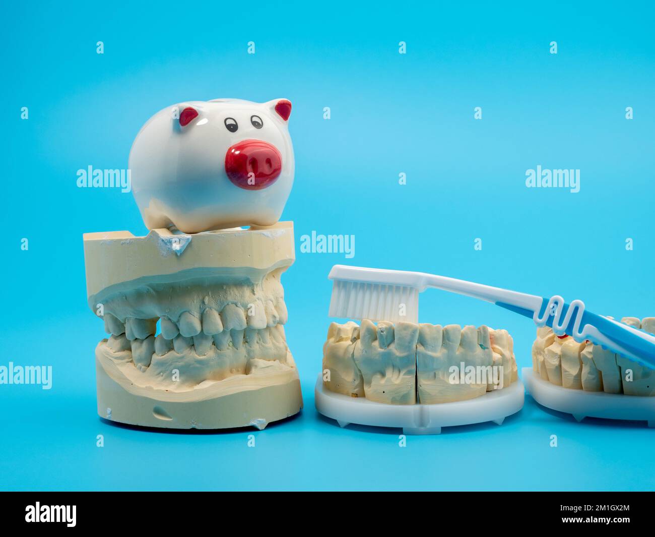 Dental casts and a piggy bank on a blue background. Plaster model of ...
