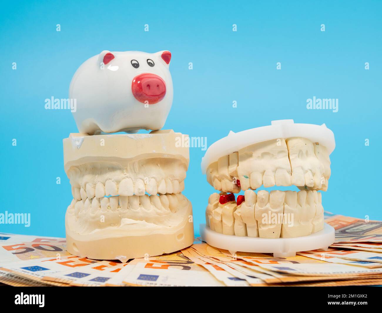 Dental casts, piggy bank and banknotes on a blue background. Plaster ...