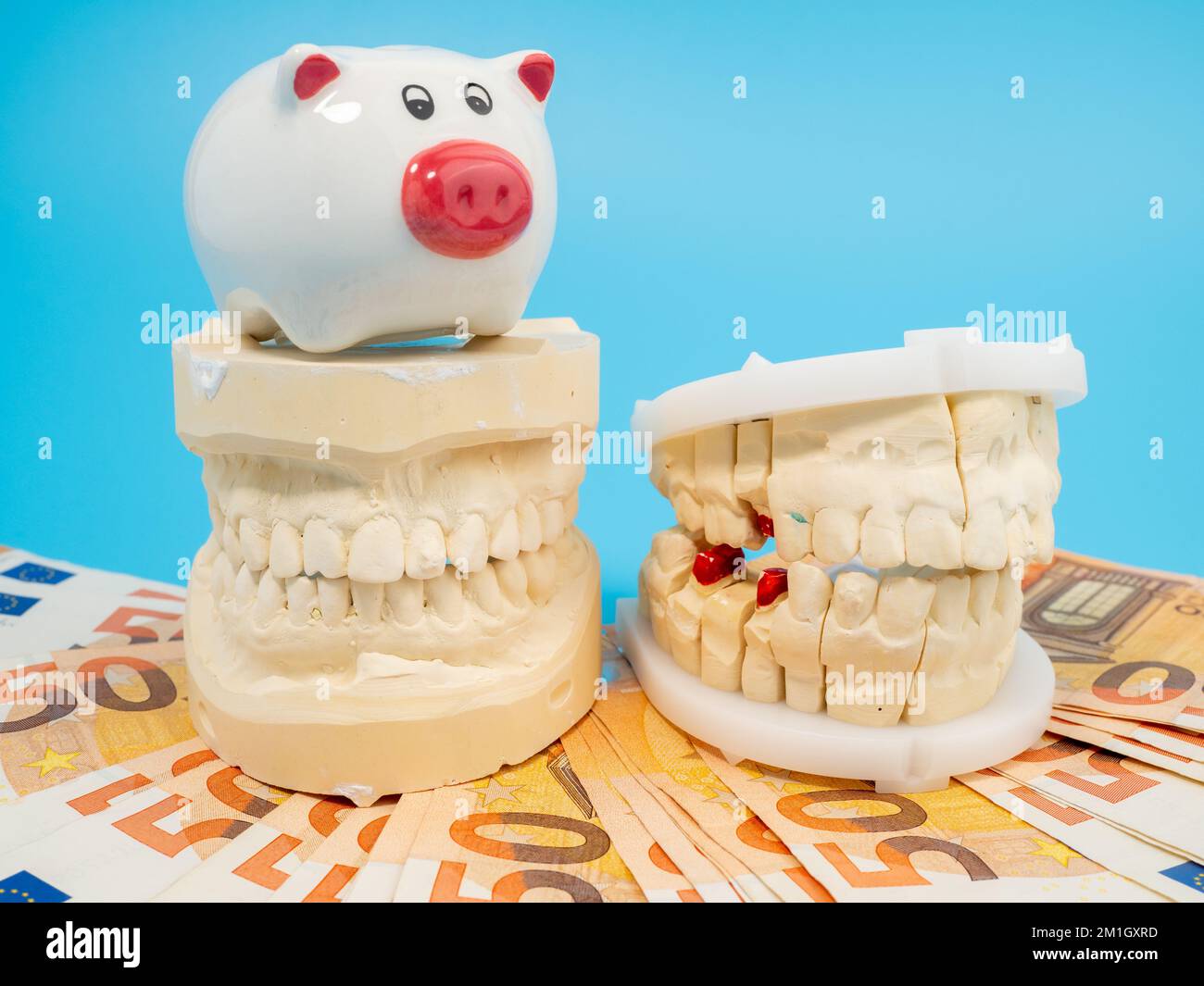 Dental casts, piggy bank and banknotes on a blue background. Plaster ...