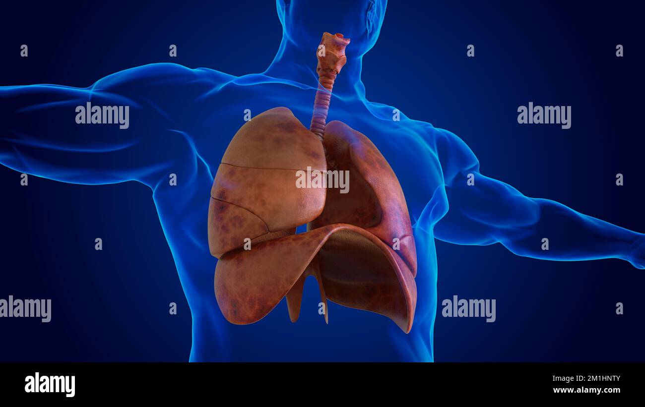 human damage lungs anatomy for medical concept 3D illustration Stock ...