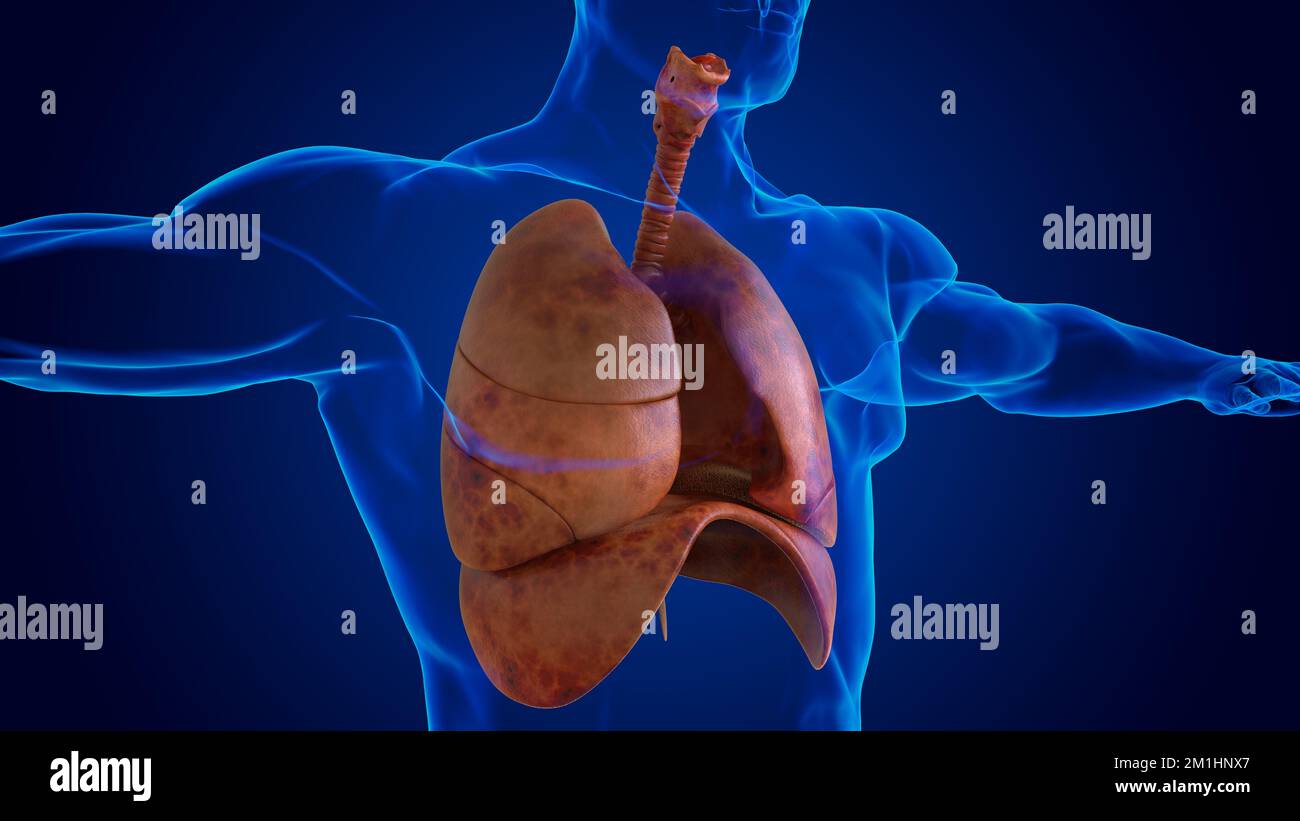 human damage lungs anatomy for medical concept 3D illustration Stock ...