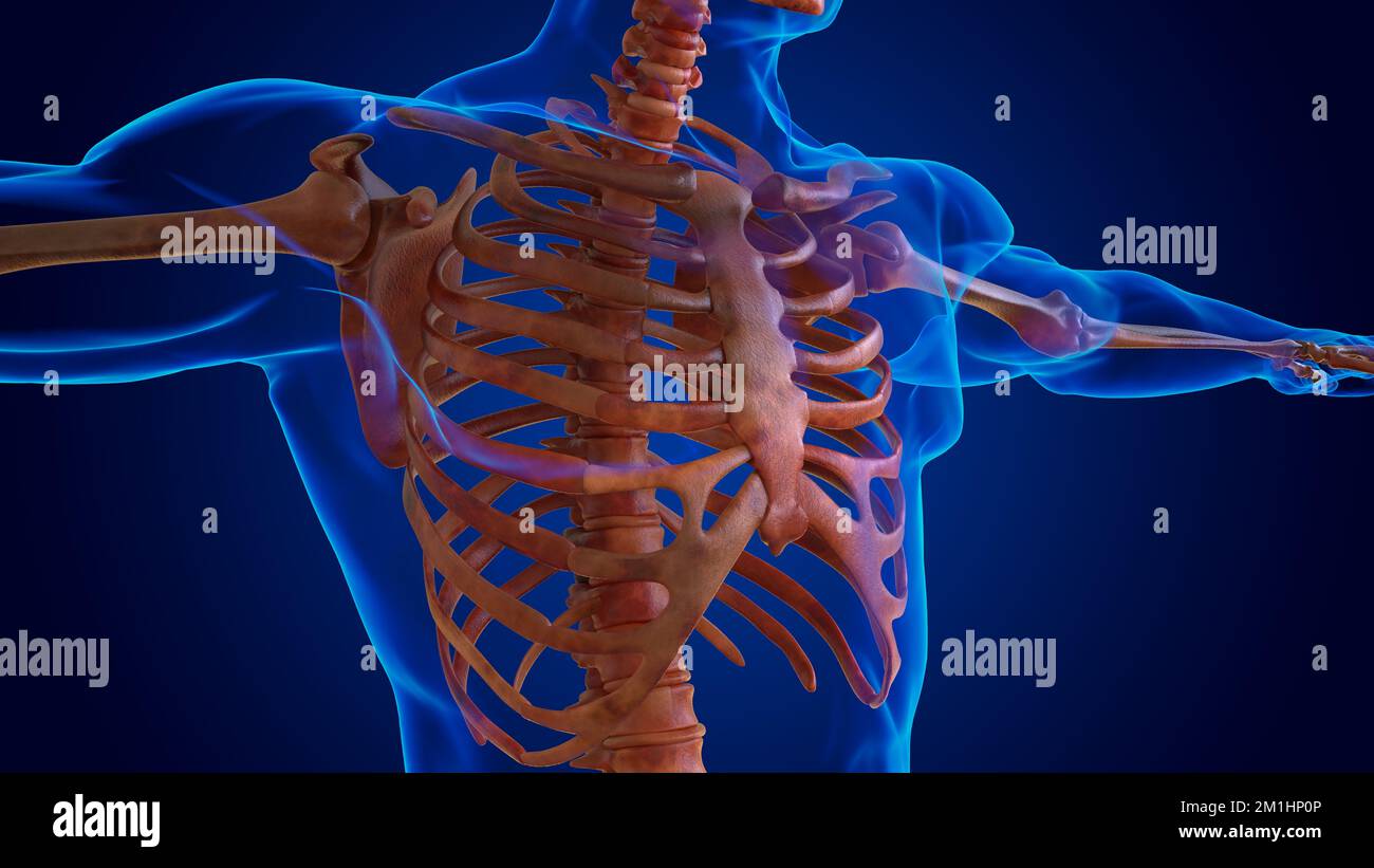 Spinal column damage hi-res stock photography and images - Alamy