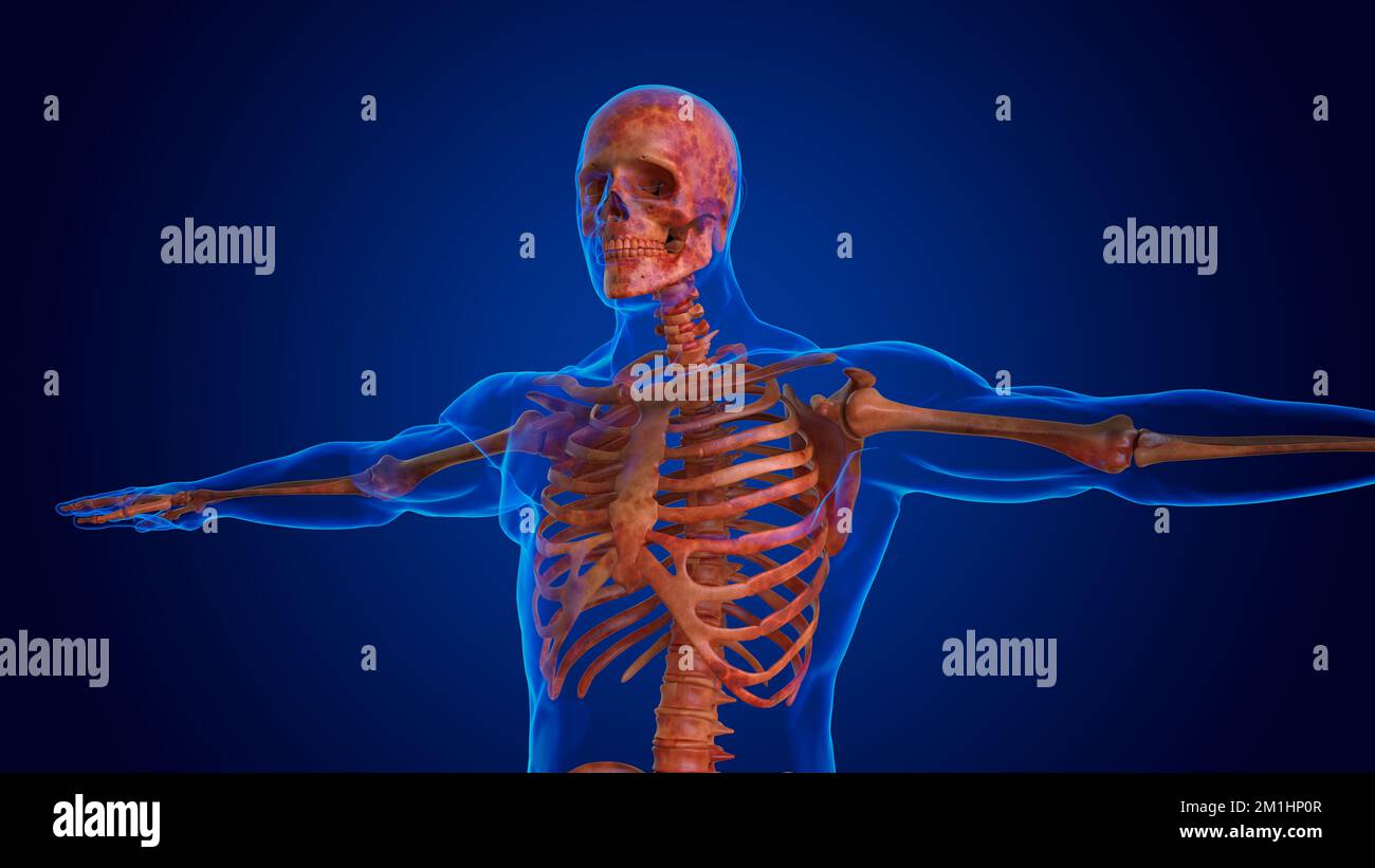 Spinal column damage hi-res stock photography and images - Alamy