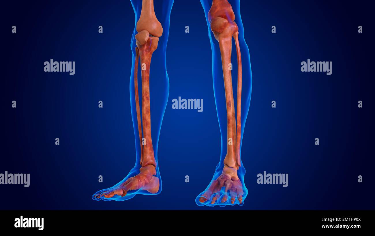 human damage skeleton all bones for medical concept 3D illustration ...