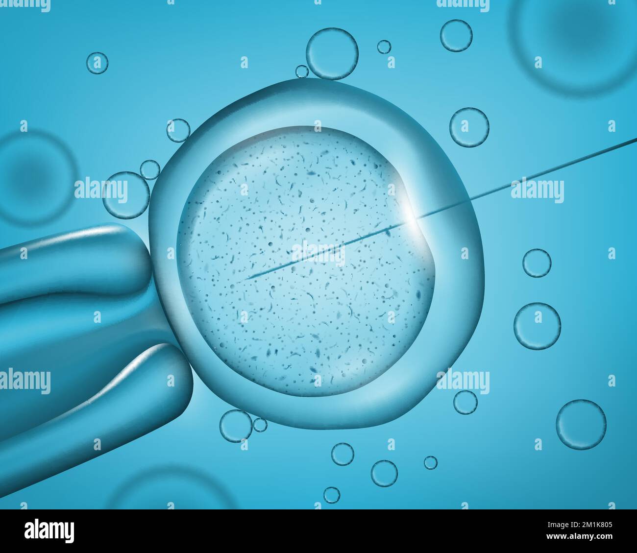 Laser needle injection to cell. Medical operation. Human DNA research ...