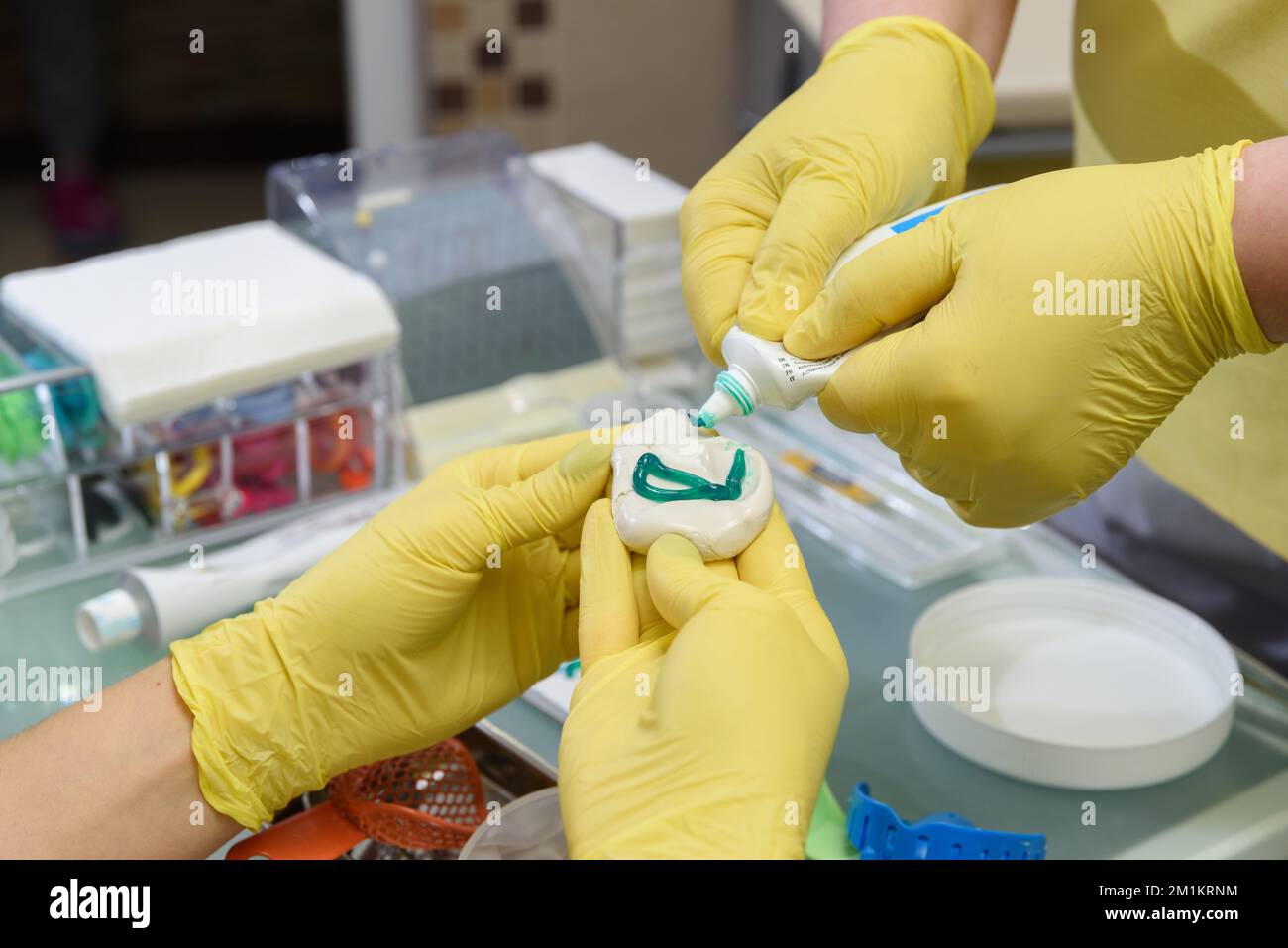 The orthodontist prepares a special paste for making an impression of ...