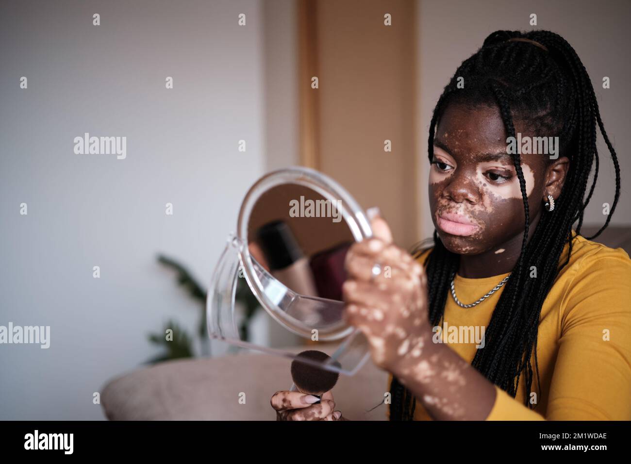 African American lady applying powder on face with vitiligo Stock Photo ...