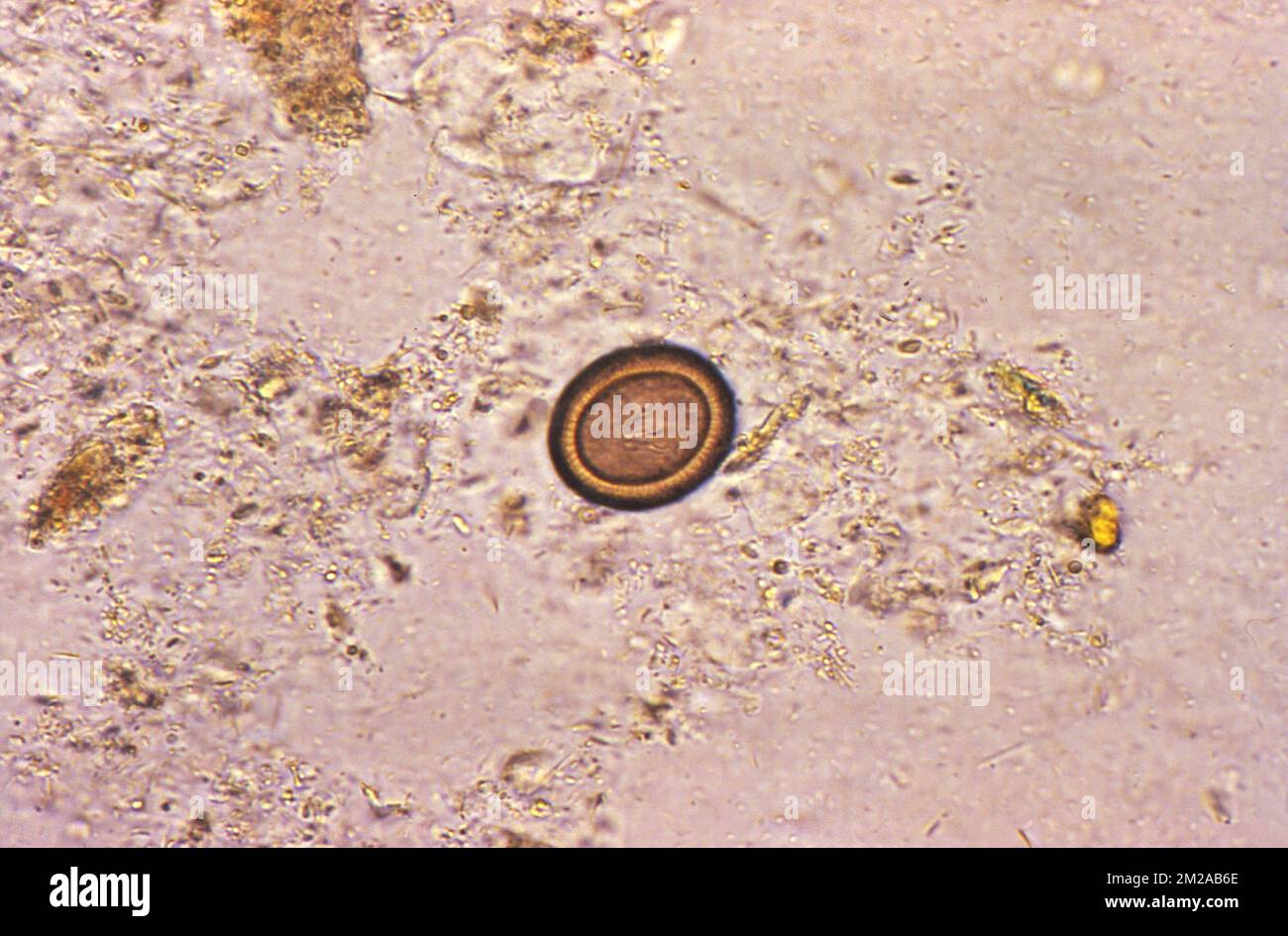 Ovum of a tapeworm, light micrograph Stock Photo - Alamy
