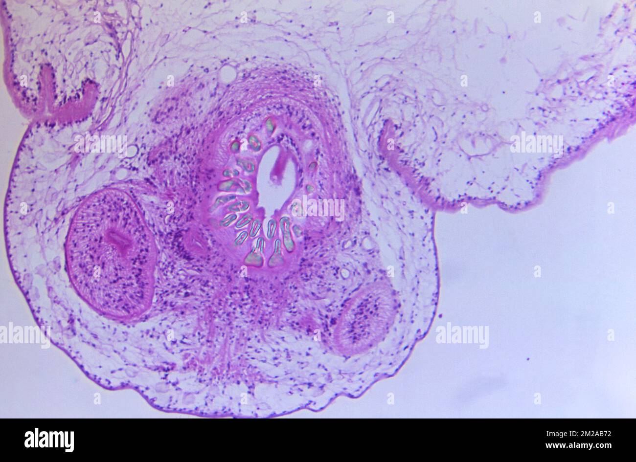 Larval scolex inside a tapeworm coenurus, light micrograph Stock Photo ...