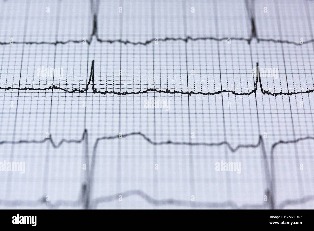 Cardiologue hi-res stock photography and images - Alamy