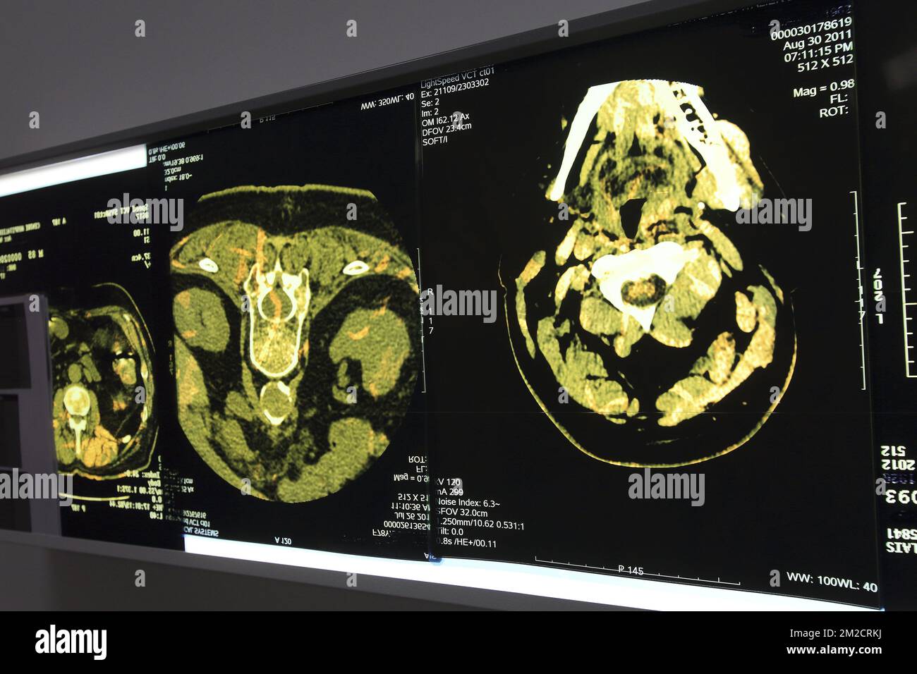 Appareil medical hi-res stock photography and images - Alamy