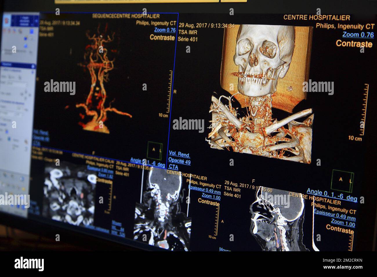 Appareil medical hi-res stock photography and images - Alamy