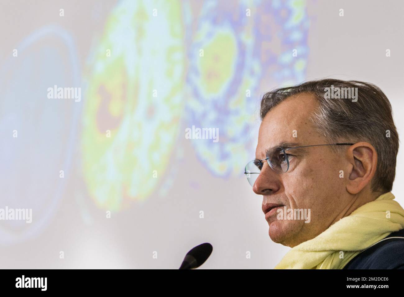 Hersentumor hi-res stock photography and images - Alamy