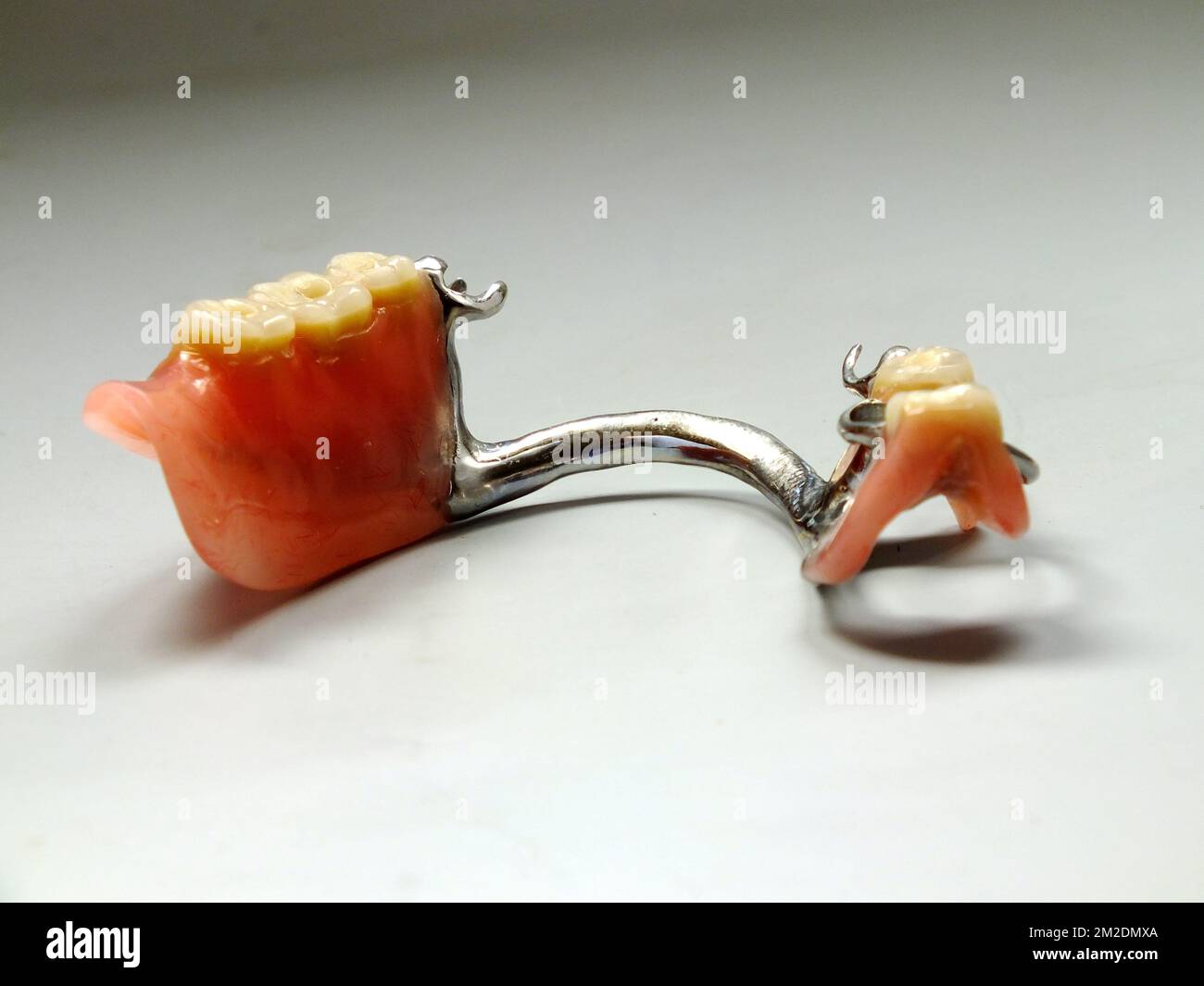 Dental prosthesis | Prothèse dentaire 13/03/2018 Stock Photo - Alamy