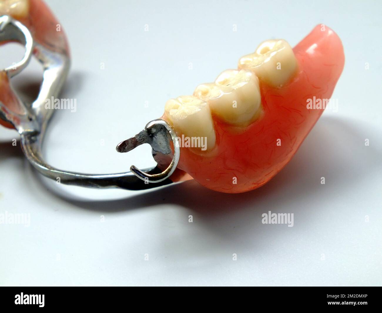 Dental prosthesis | Prothèse dentaire 13/03/2018 Stock Photo - Alamy