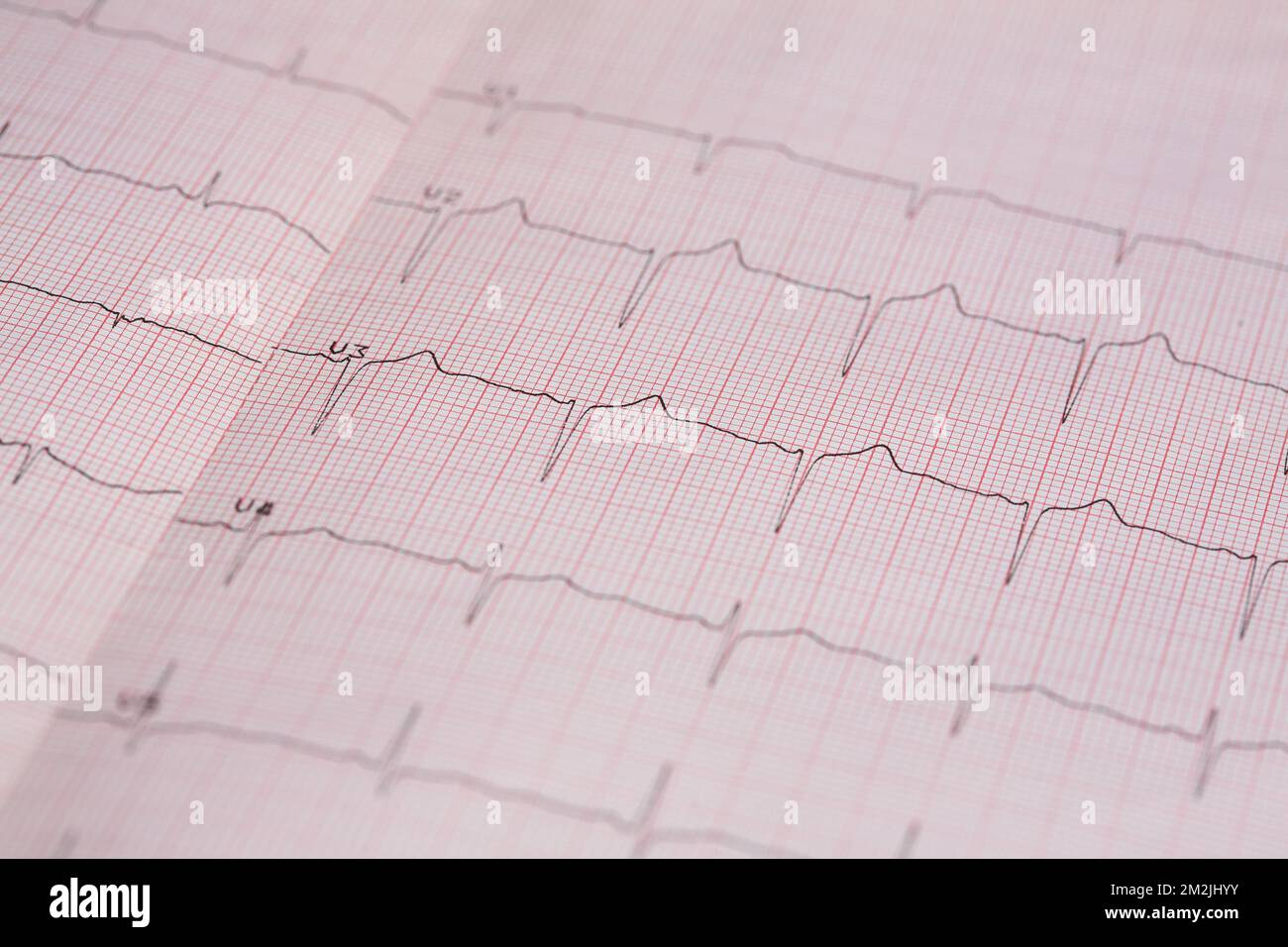 Eeg chart graph hi-res stock photography and images - Alamy