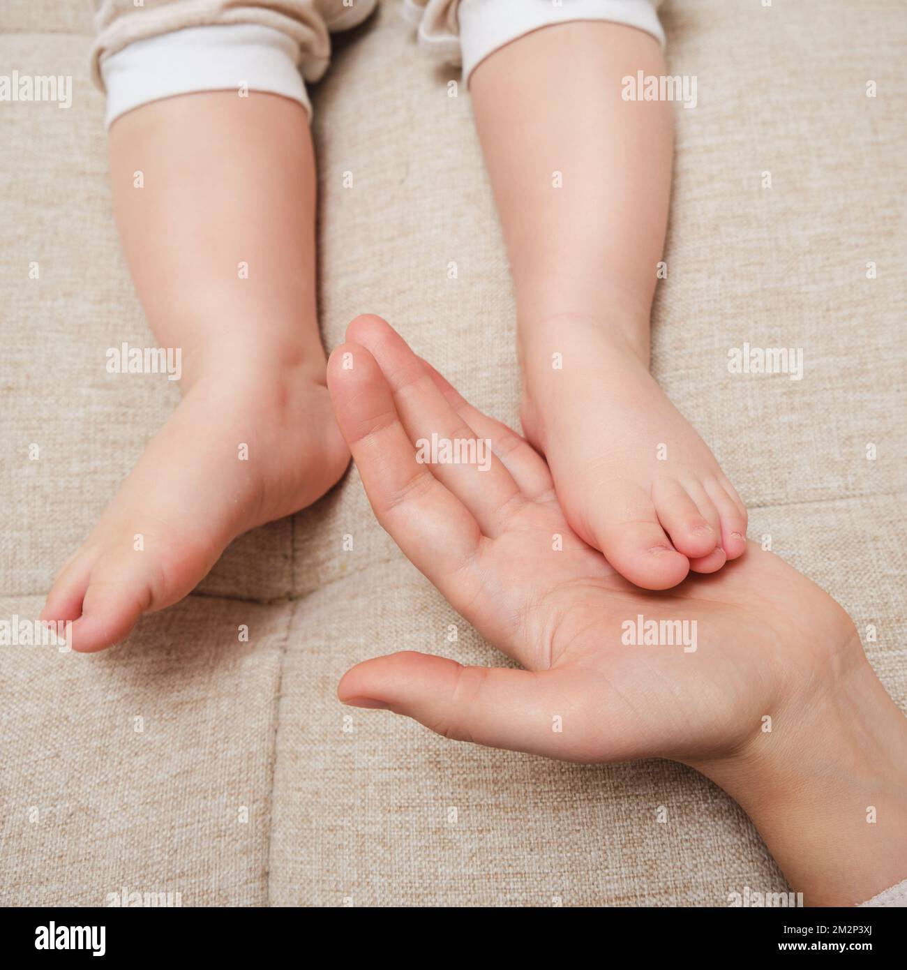 Deformed toes on the foot of the toddler baby, congenital curvature ...