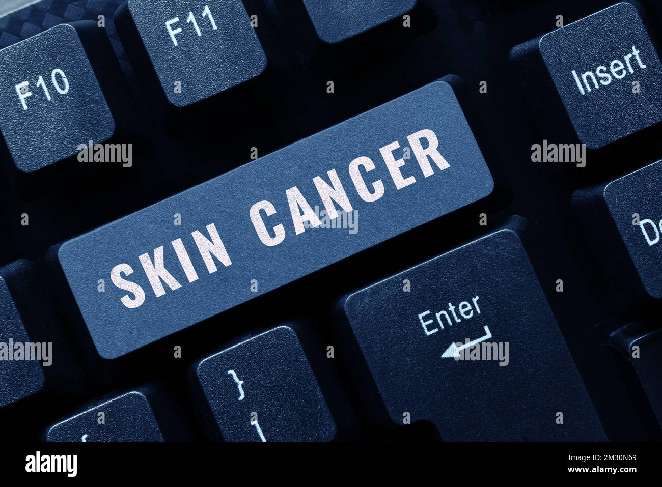 Text sign showing Skin Cancer. Word for uncontrolled growth of abnormal ...