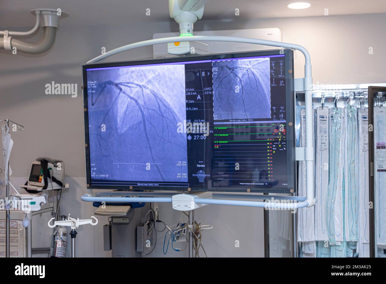 Istanbul, Turkey - September 20, 2022 ; heart operating room. Complex ...