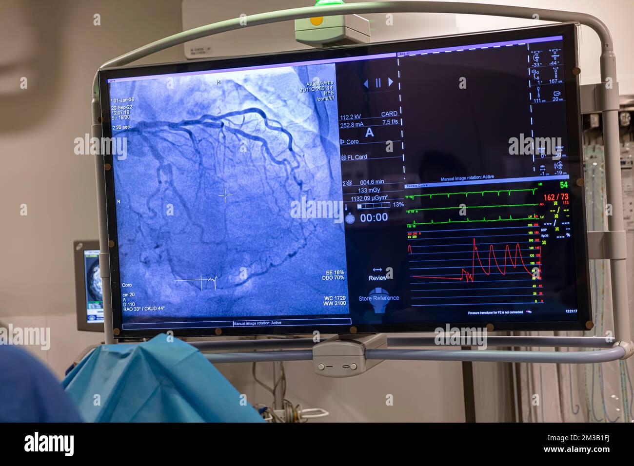 Istanbul, Turkey - September 20, 2022 ; heart operating room. Complex ...