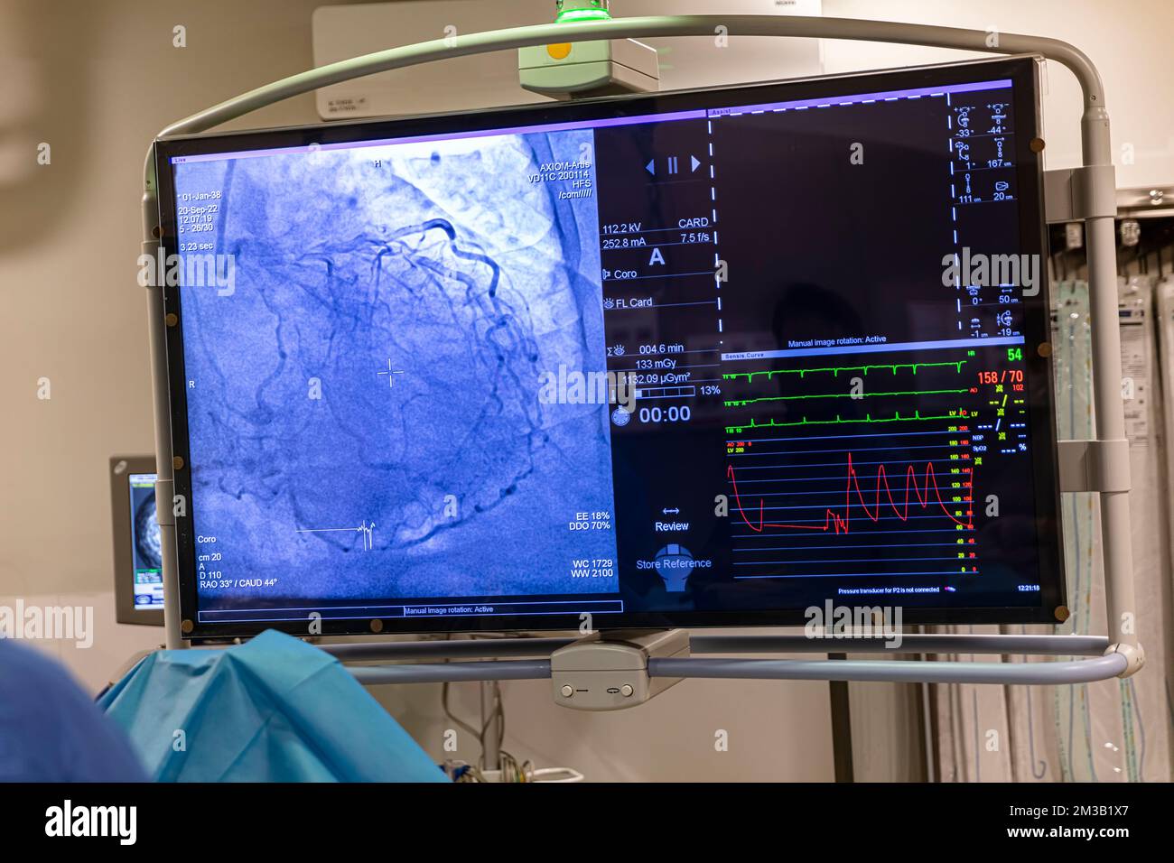 Istanbul, Turkey - September 20, 2022 ; heart operating room. Complex ...