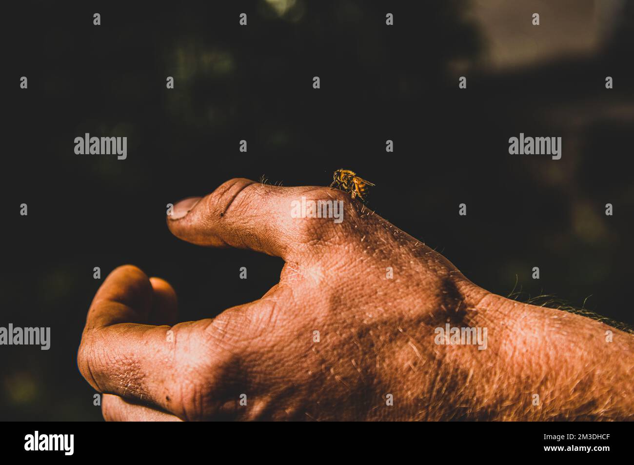 Bee sting hand hi-res stock photography and images - Alamy