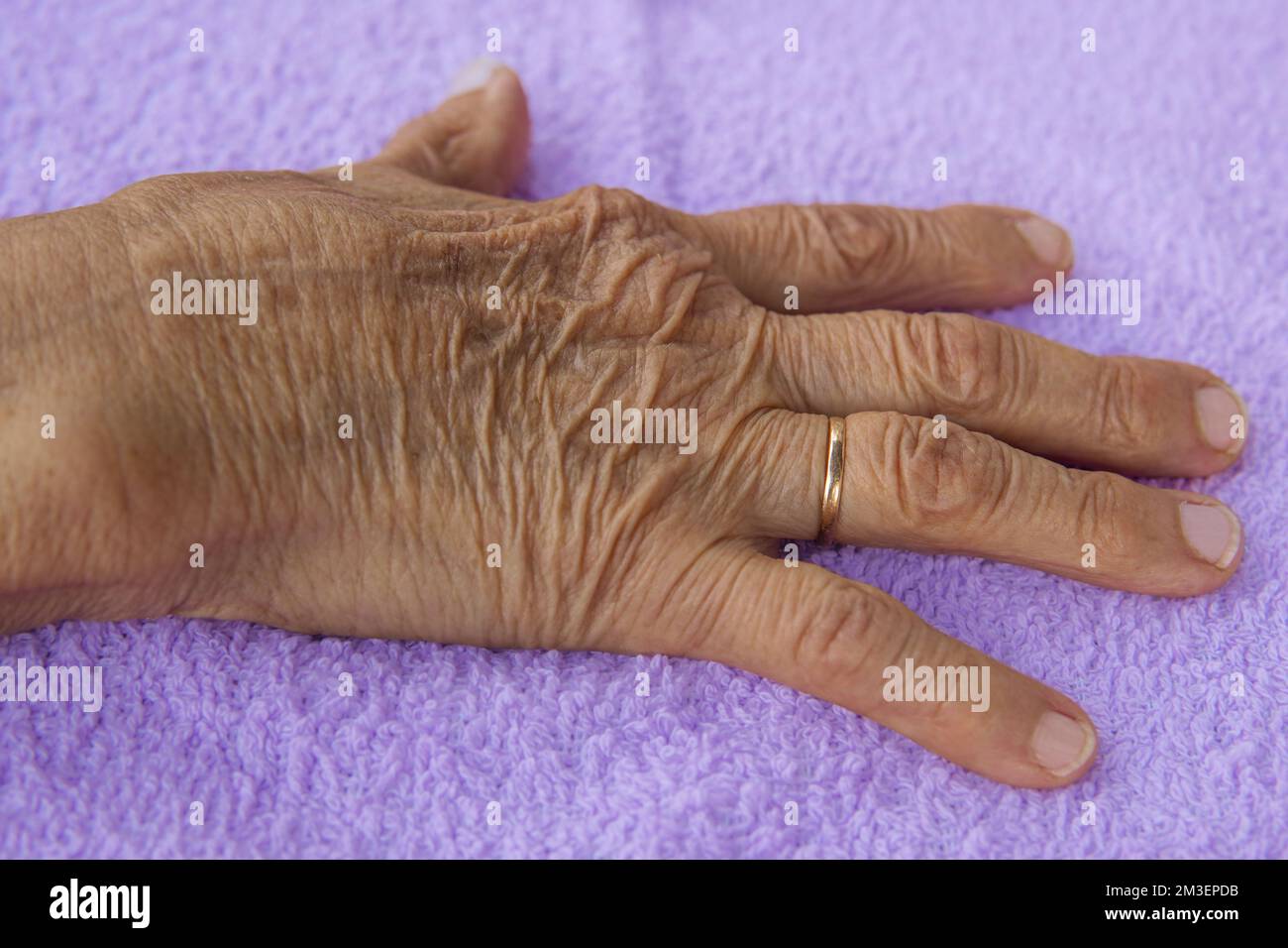 A wrinkled hand with arthritis on a purple background. disease in the ...