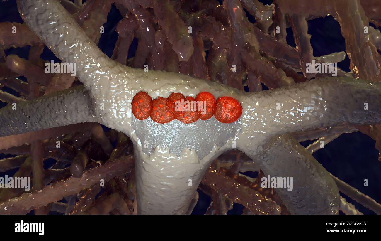 3d illustration of Osteoclaste, medically accurate, Bone modeling and ...