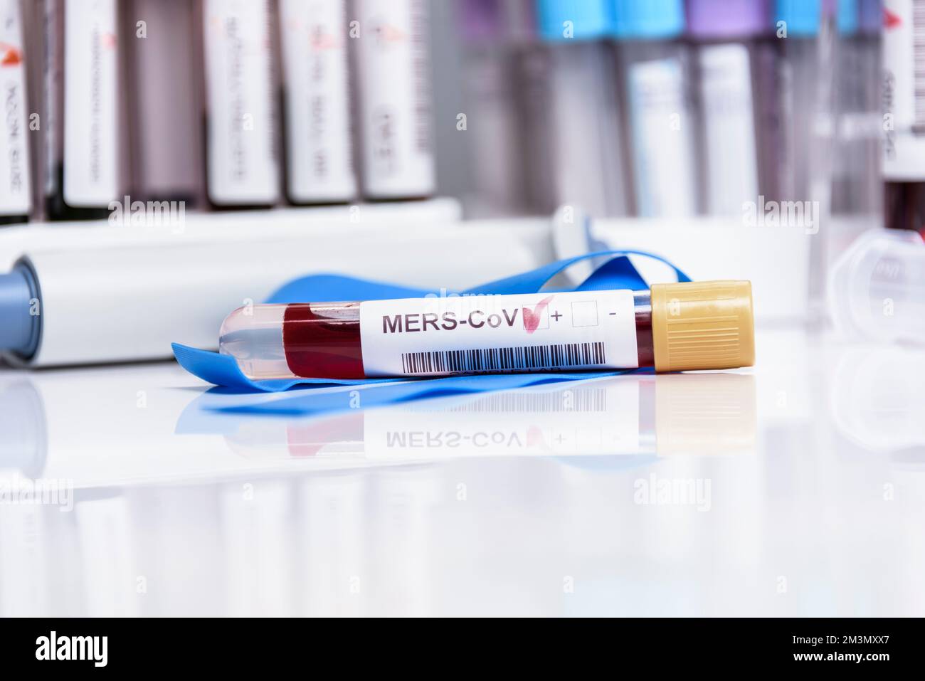Close-up of laboratory sample positive for MERS-CoV infection Stock Photo - Alamy