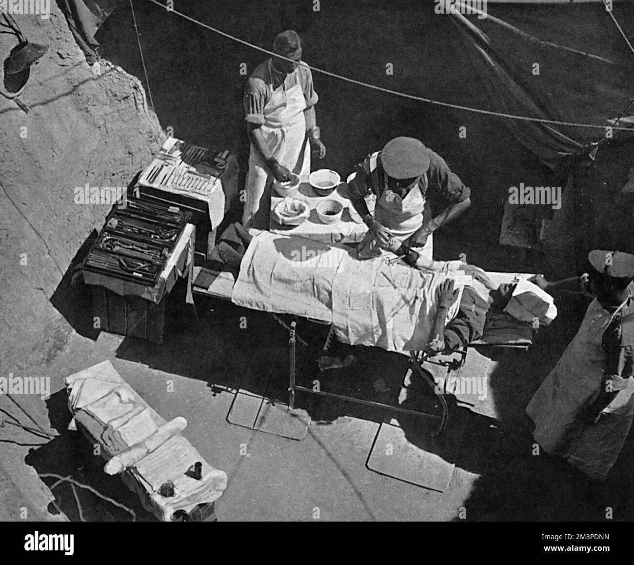 Field surgery in the Dardanelles, WW1 Stock Photo - Alamy