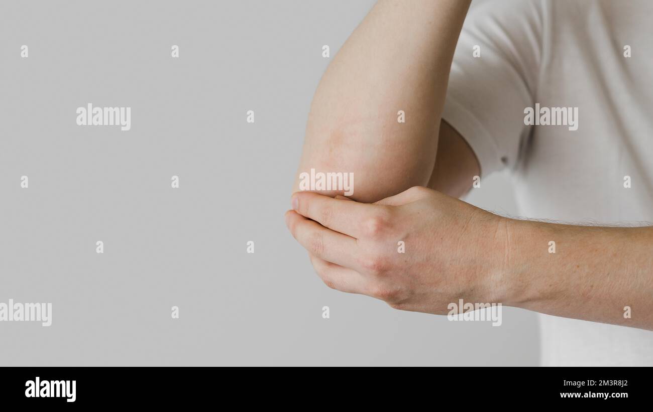 Close up patient elbow issues Stock Photo - Alamy