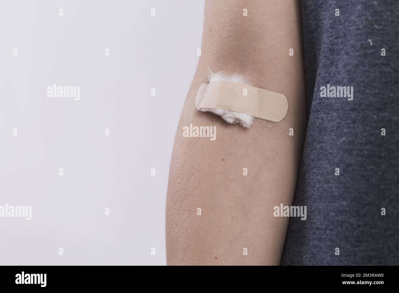 Plaster arm, Resolution and high quality beautiful photo Stock Photo ...