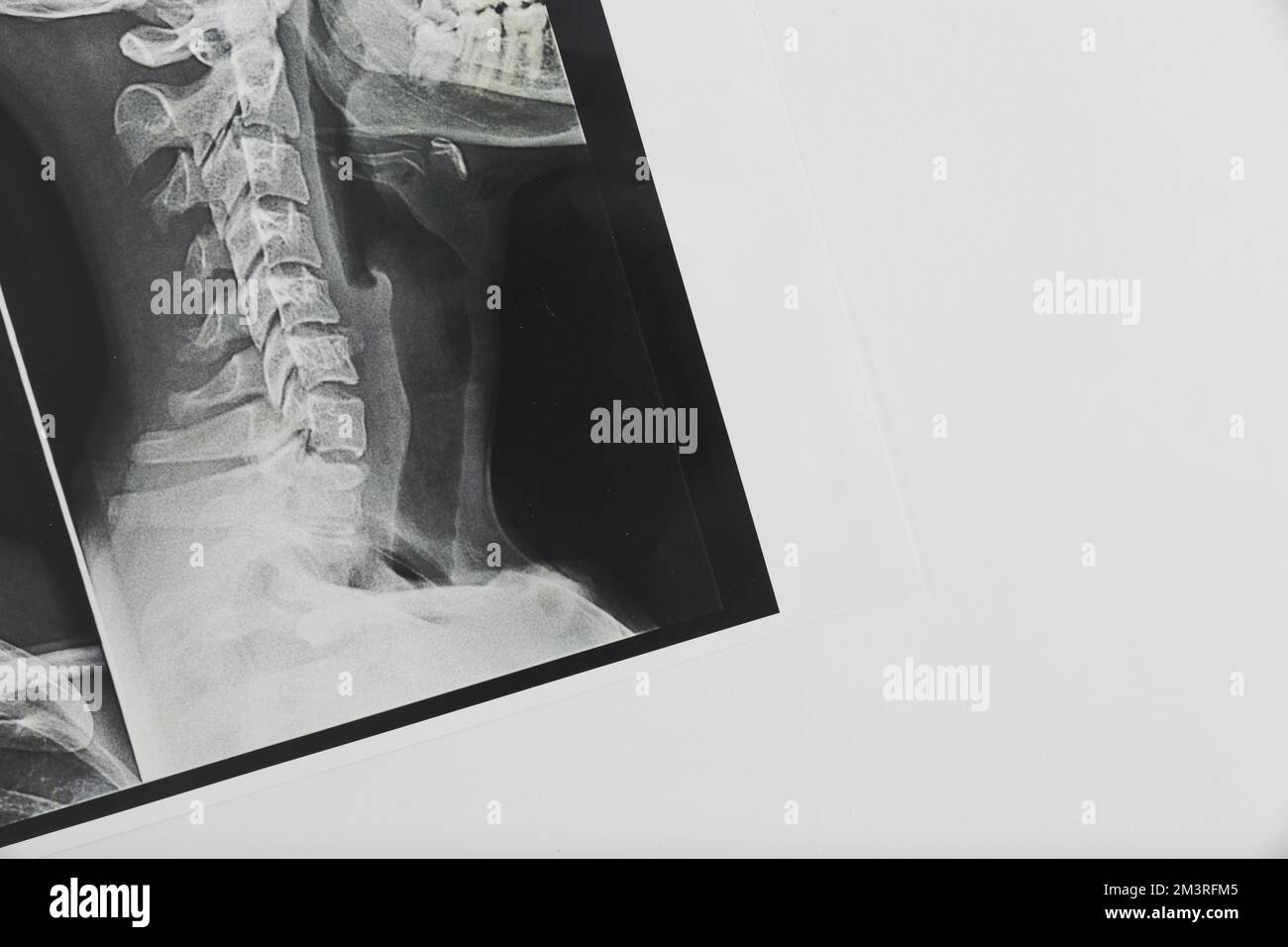 X ray scan. Resolution and high quality beautiful photo Stock Photo - Alamy