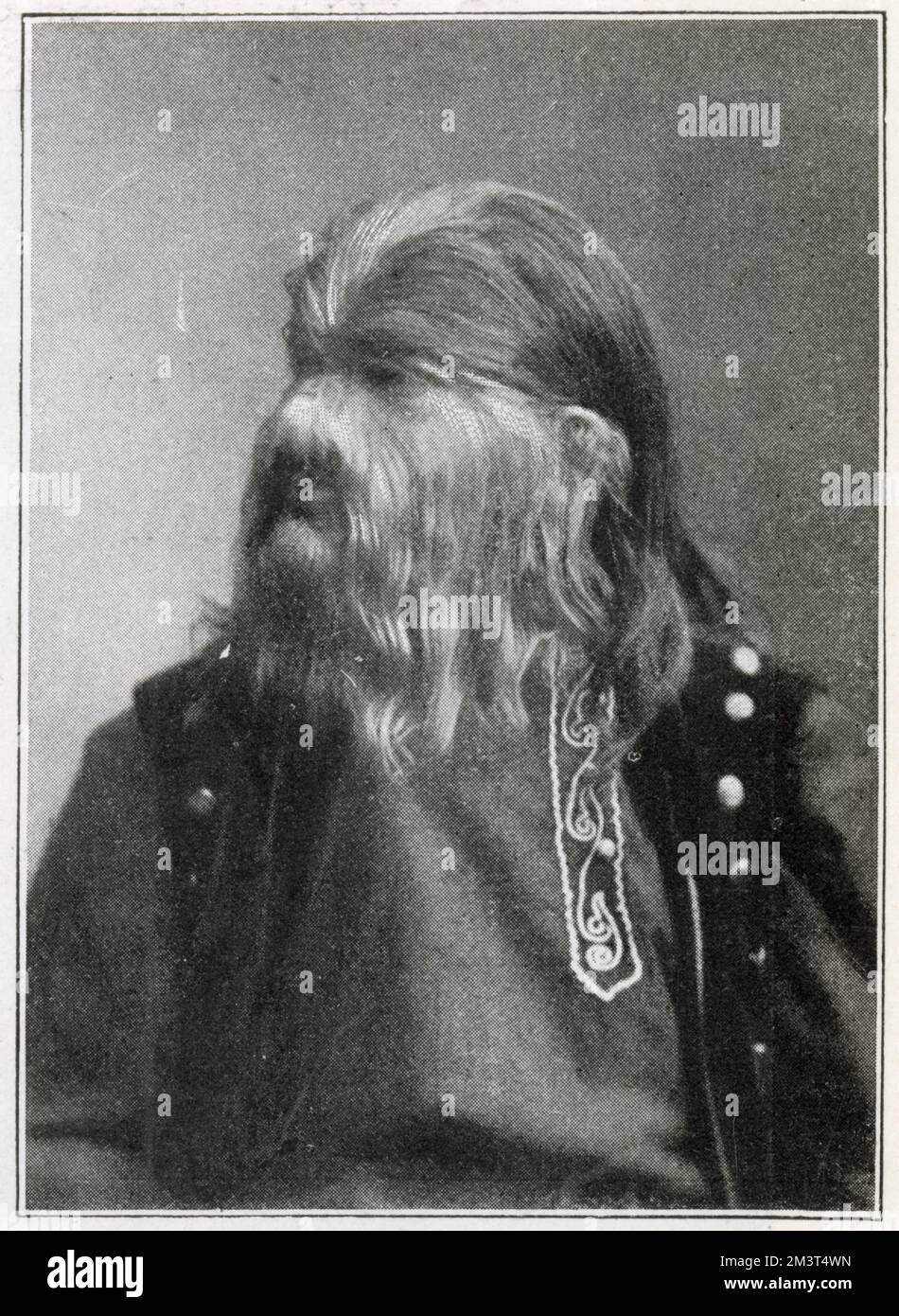 Stephan Bibrowski - Lionel the Lion-faced Man Stock Photo - Alamy