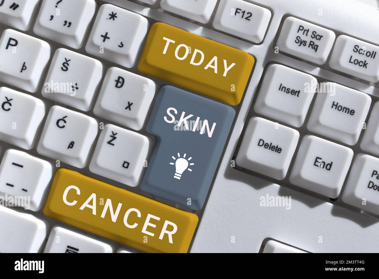 Hand writing sign Skin Cancer. Business showcase uncontrolled growth of ...