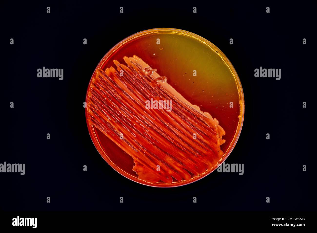 Bacteria colonies dish hi-res stock photography and images - Alamy
