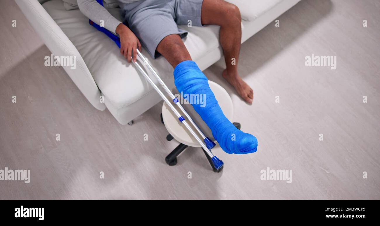 Young Man With Broken Leg Sitting On Sofa Stock Photo - Alamy