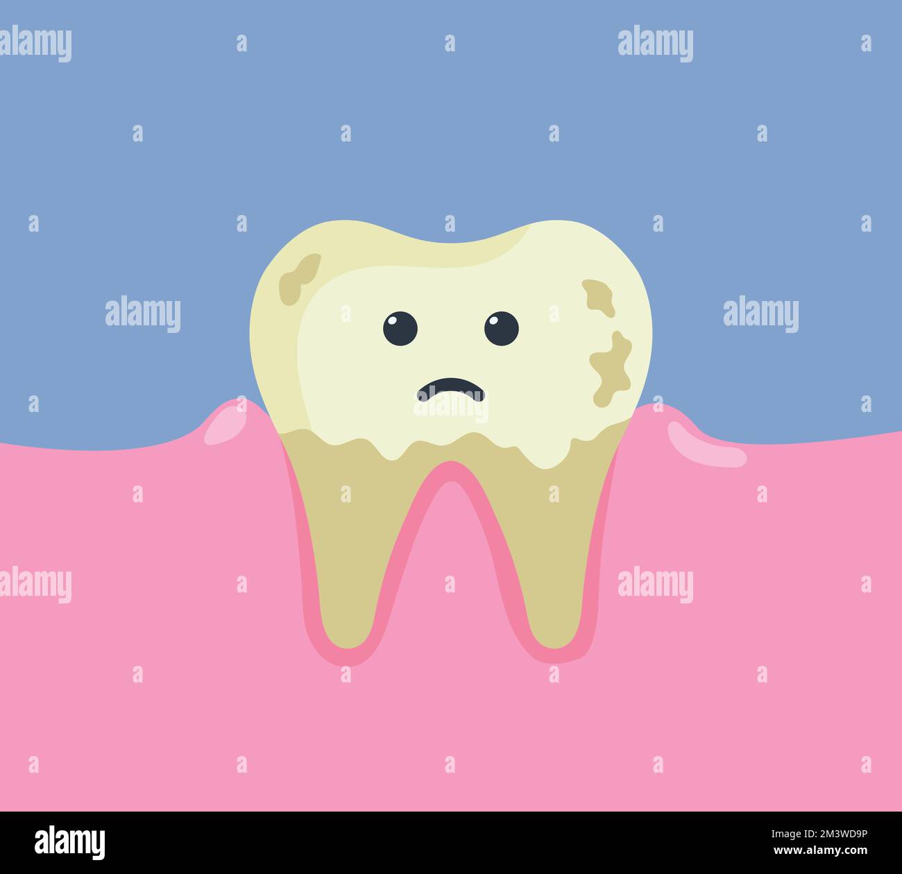 Unhealthy Tooth. Illustration Of Sick Tooth With Rotten Roots. children ...