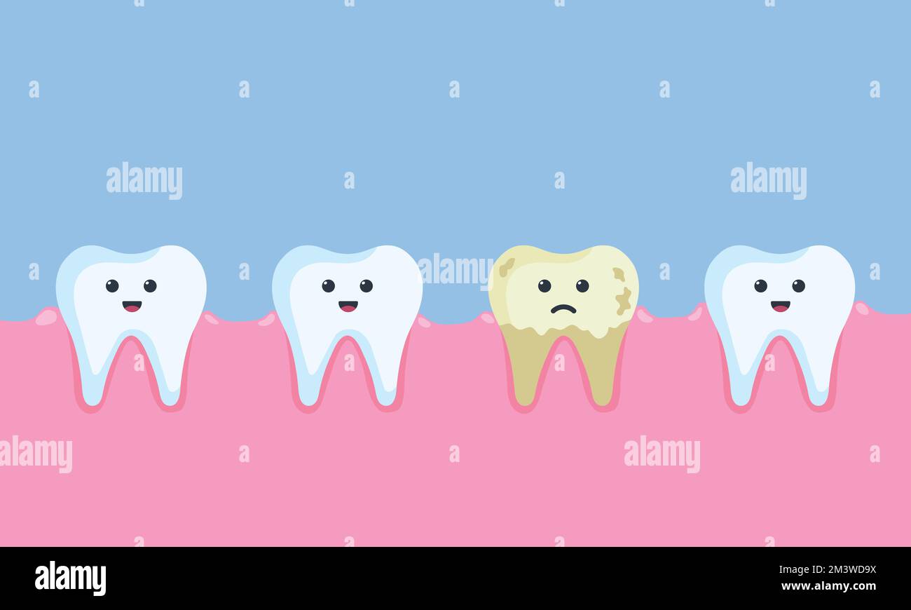 Healthy white teeth and yellow spoiled sad tooth. children dentistry ...