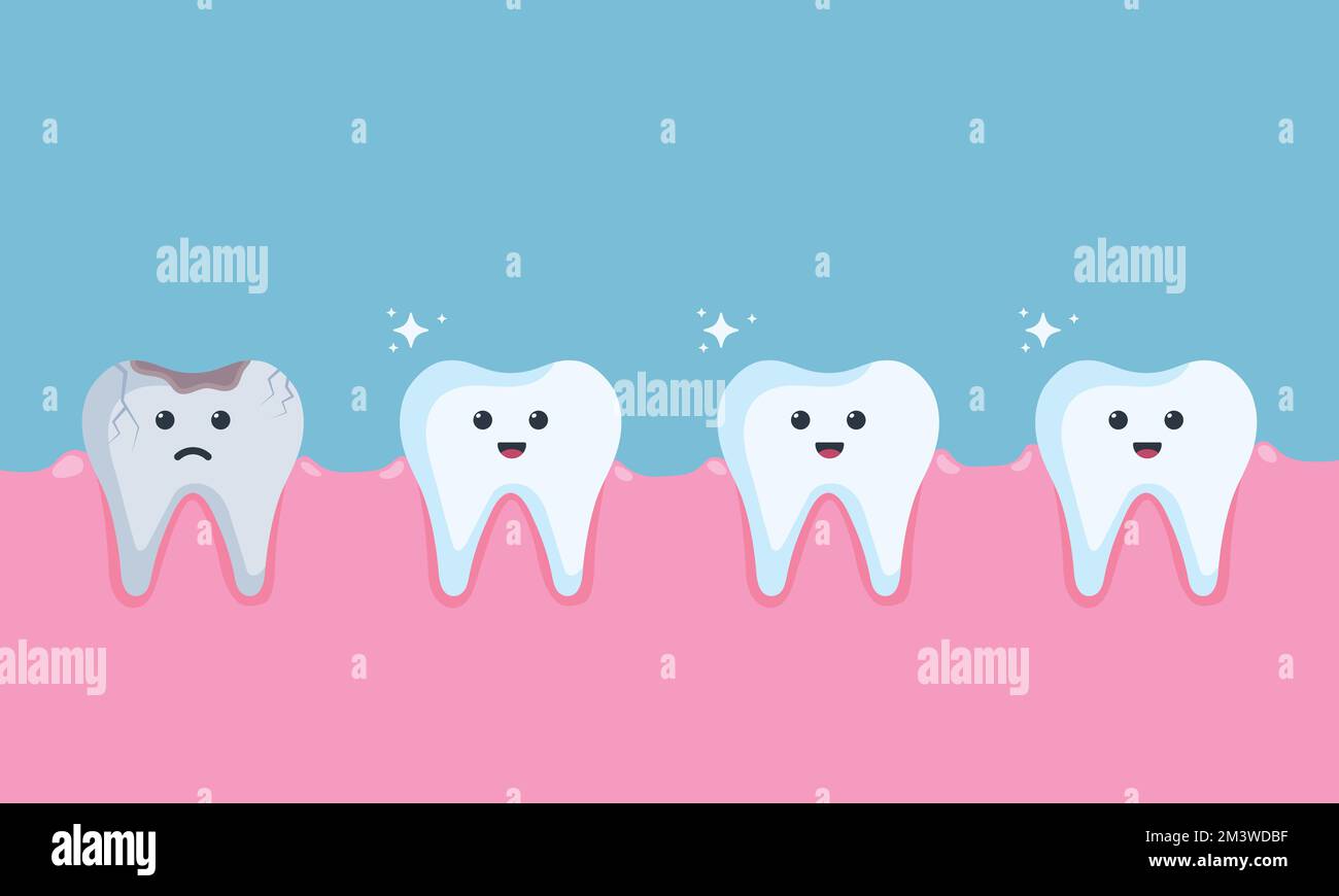 Healthy white teeth and damaged darkened tooth with hole. children ...