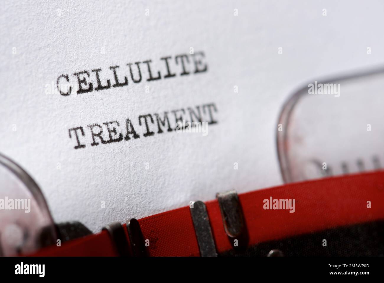 Cellulite treatment phrase written with a typewriter Stock Photo - Alamy