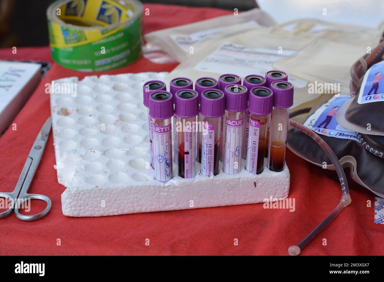 Cairo, Egypt, December 15 2022: blood samples in tubes collected from ...