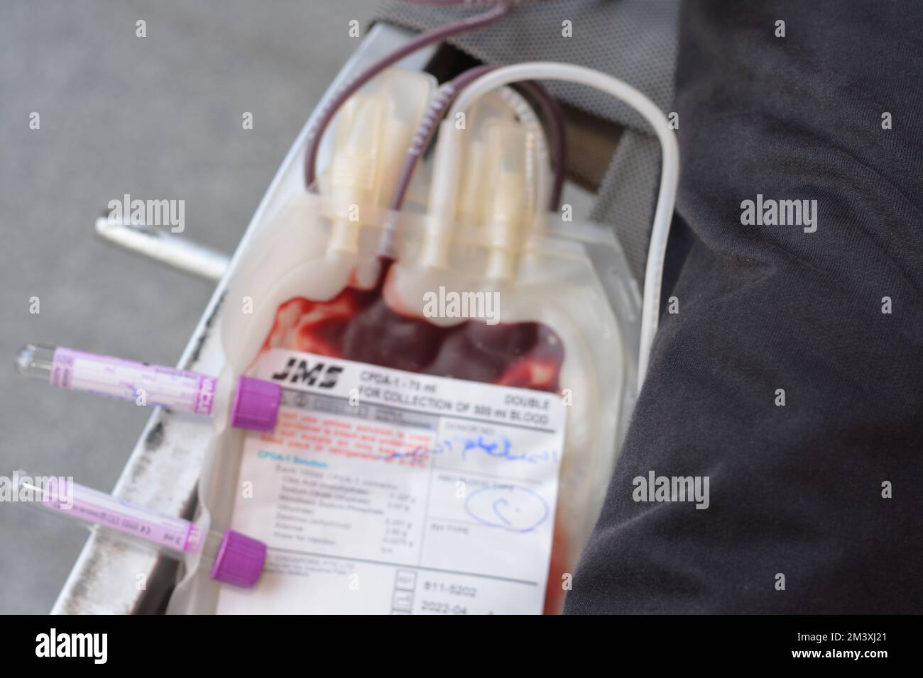 Cairo, Egypt, December 15 2022: blood bag and blood samples collected ...