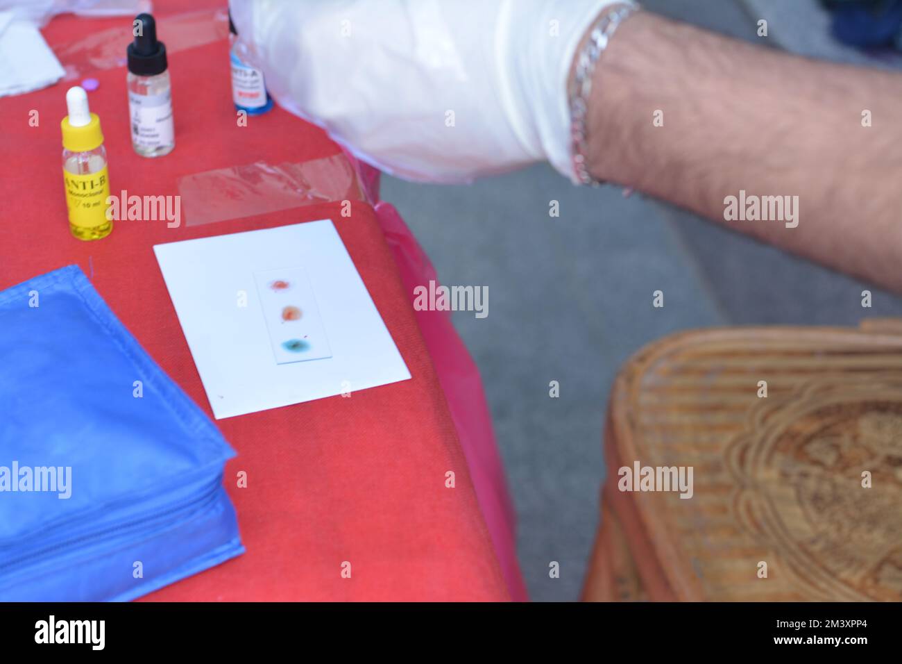 Cairo, Egypt, December 13 2022: ABO blood typing for checking the blood ...