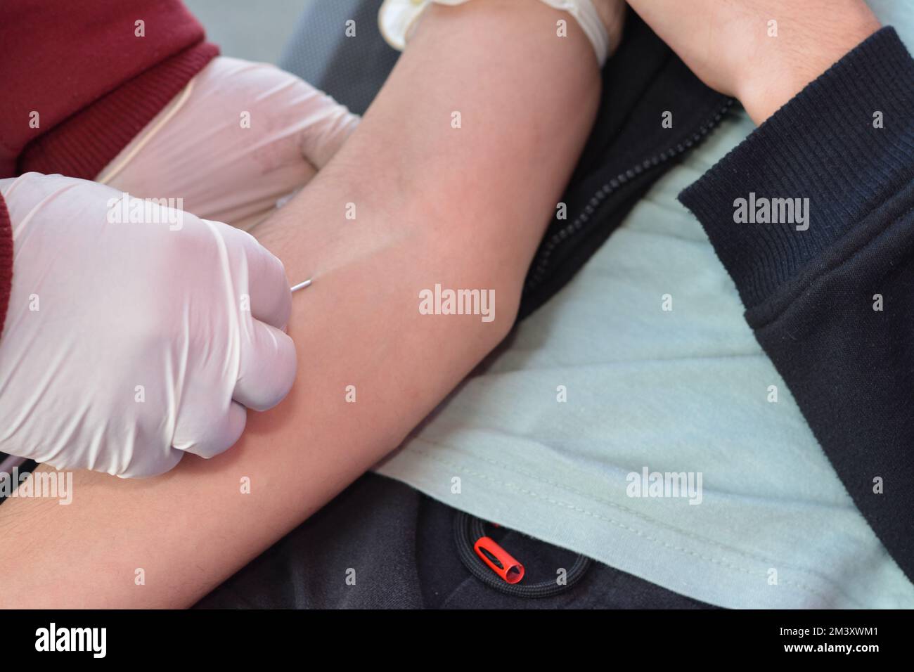 Blood donation, a blood donor volunteer with and intravenous line ...